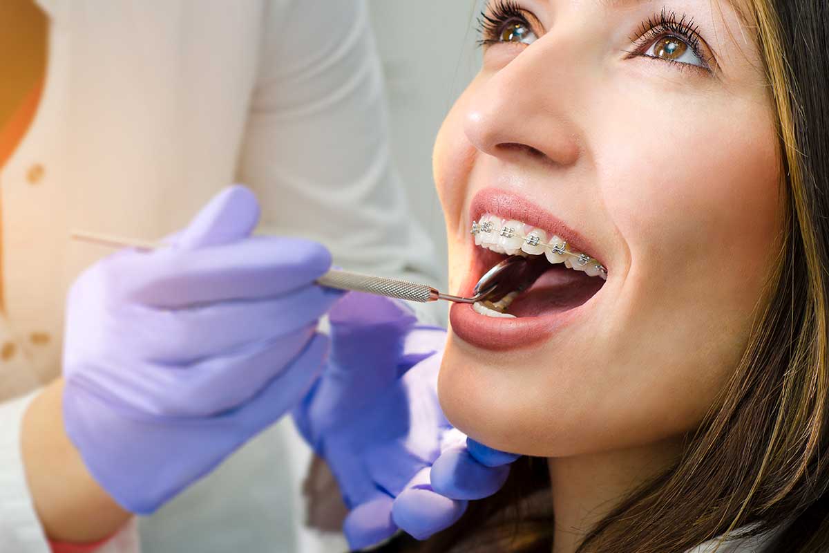Traditional Braces in Edmonton, AB | Davinci Smiles